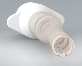 TREAT Methodology | Simbex